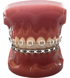 Best Power Chain Colors Picker for Braces | Elate Ortho